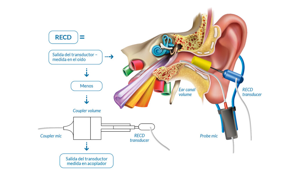 Medidas REM RECD | Revista Gaceta Audio